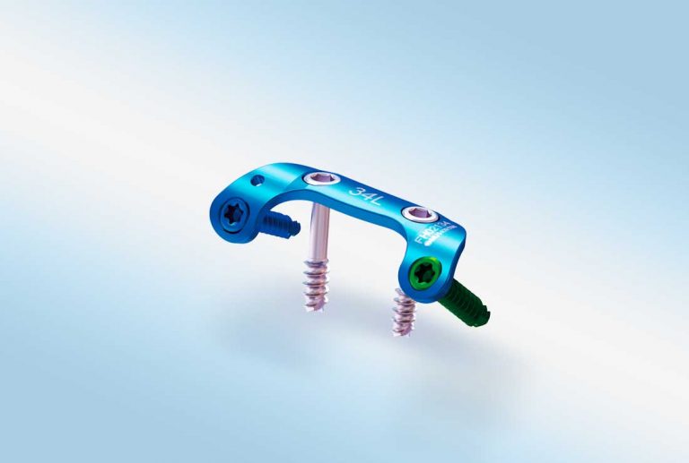 Ludloff Osteotomy Archive - Merete USA