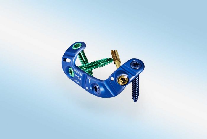 Foot & Ankle - Merete USA